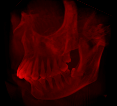 Graphics Runner: Volume Rendering 101